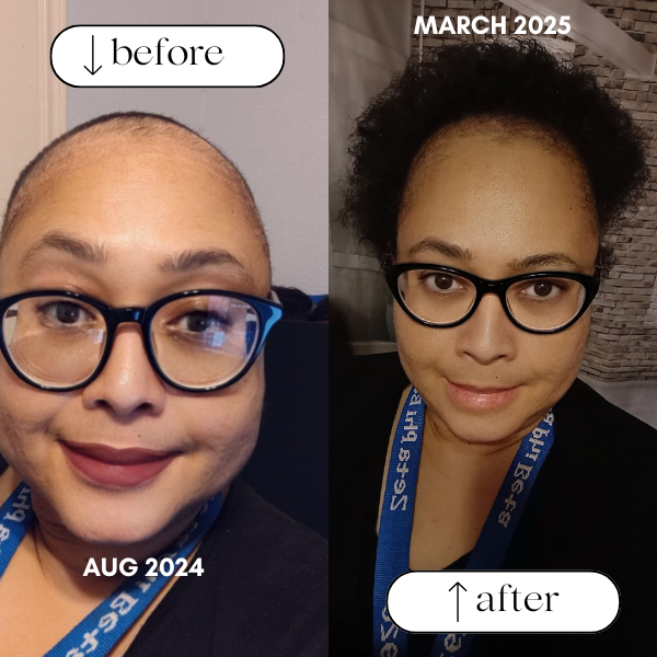 Chemo Curls: A Woman’s Journey in Navigating Through Life with Cancer ...